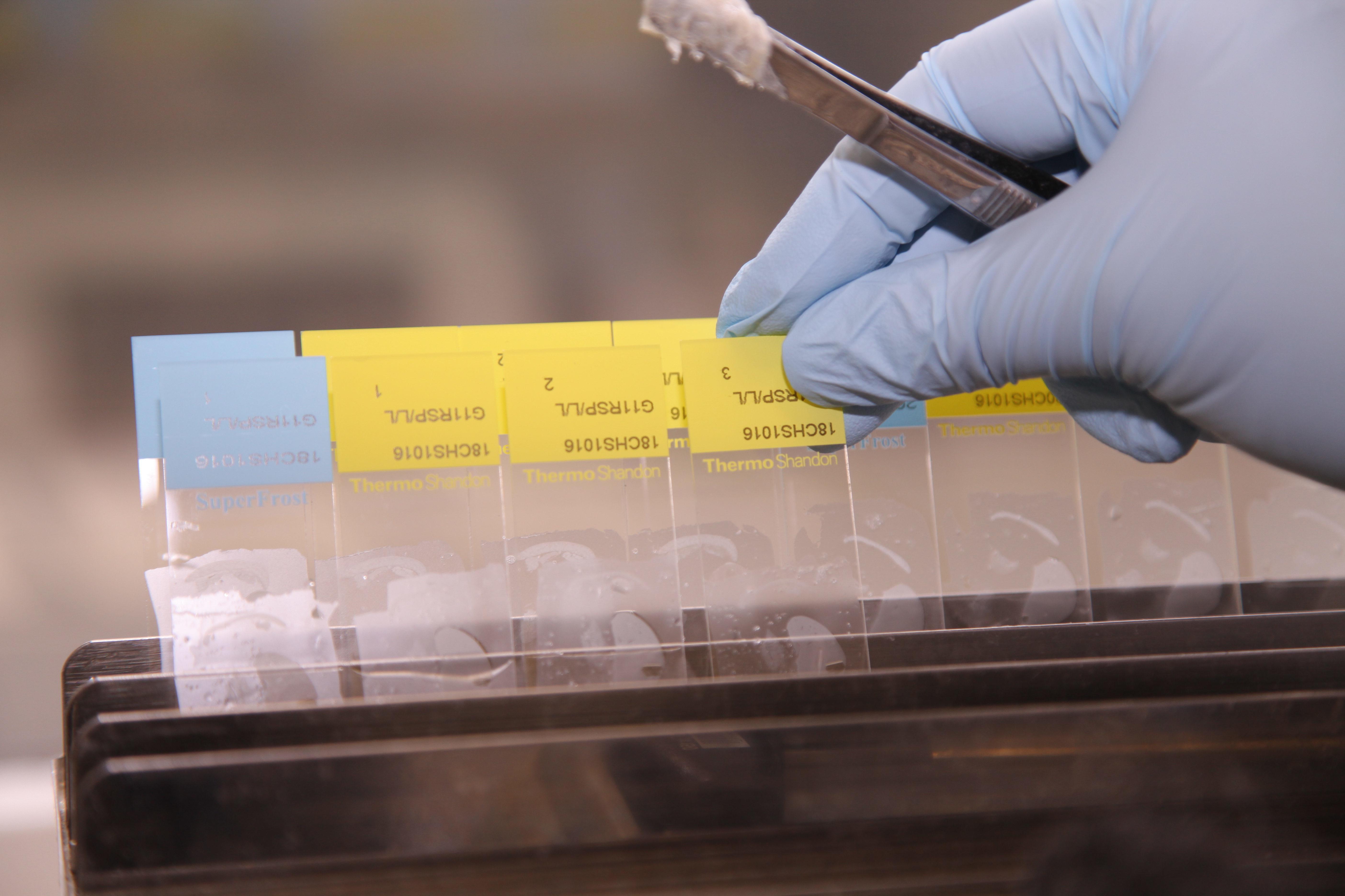 Pathology - Barts Cancer Institute - Queen Mary University of London