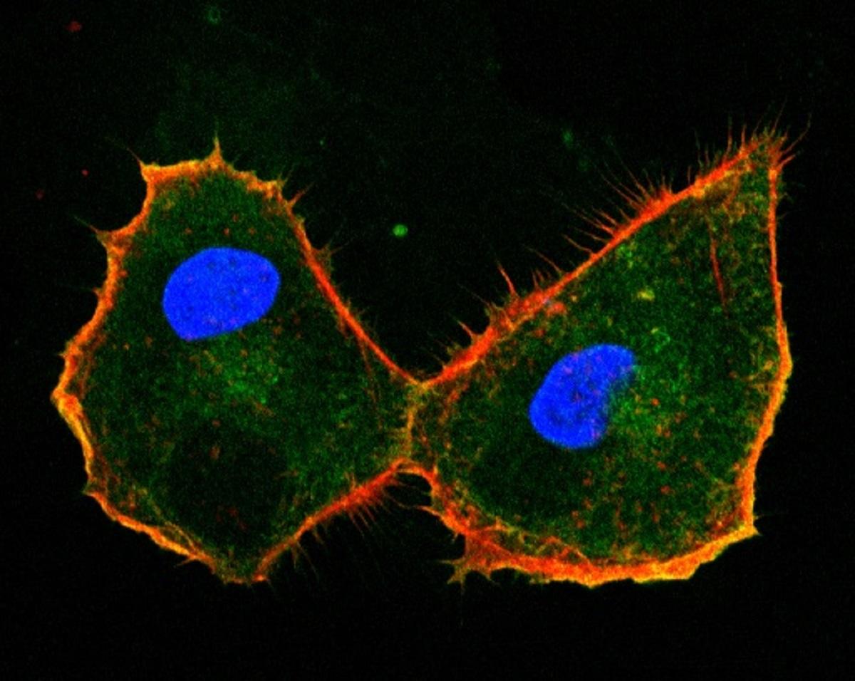 Cellular Metabolism - Barts Cancer Institute - Queen Mary University of ...