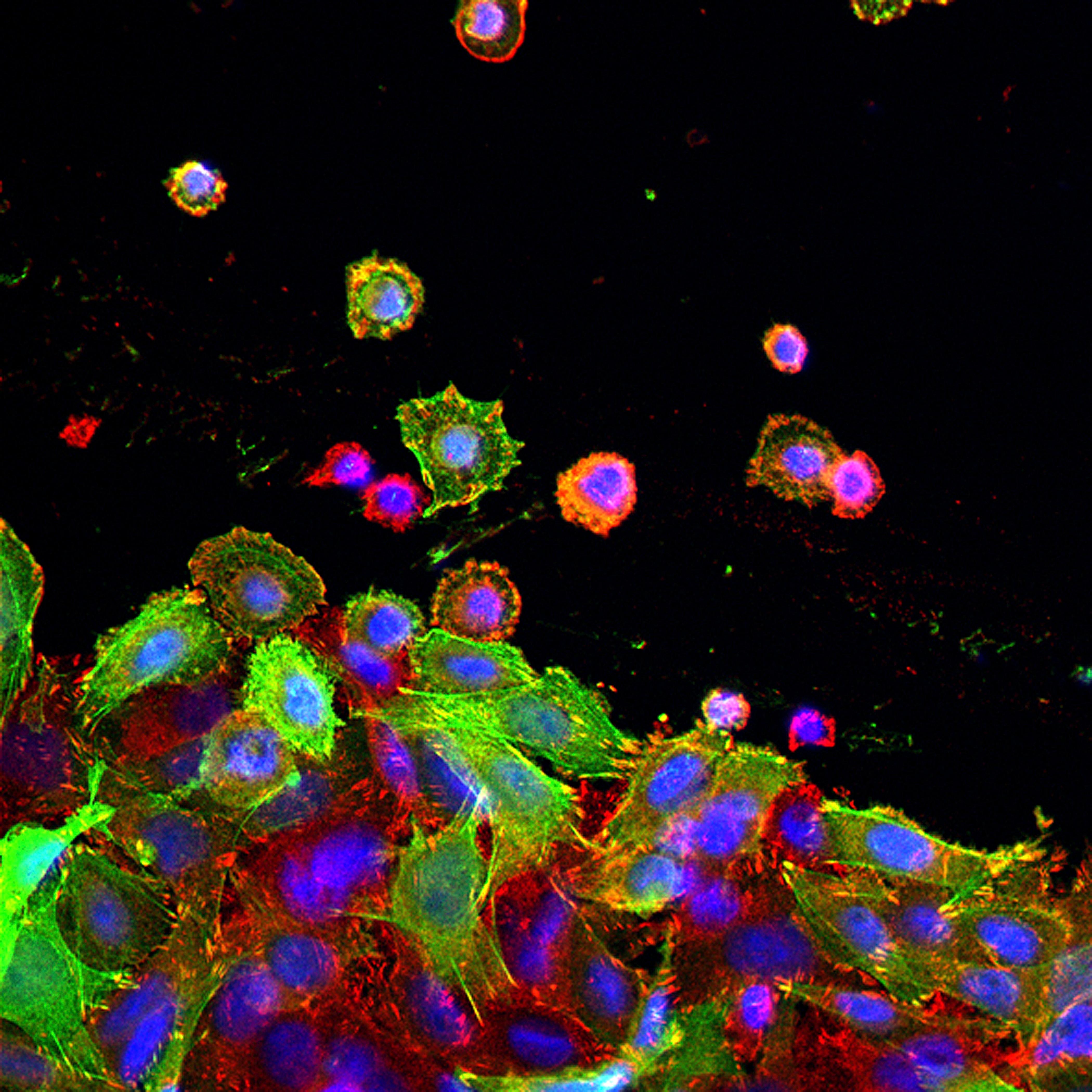 Metastasis and Invasion - Barts Cancer Institute - Queen Mary ...