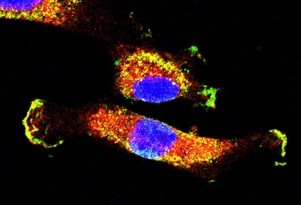 Unravelling the circuitry that controls cancer growth and spread ...