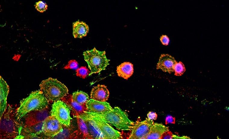 Immune ‘cloaking’ in cancer cells - Barts Cancer Institute - Queen Mary ...