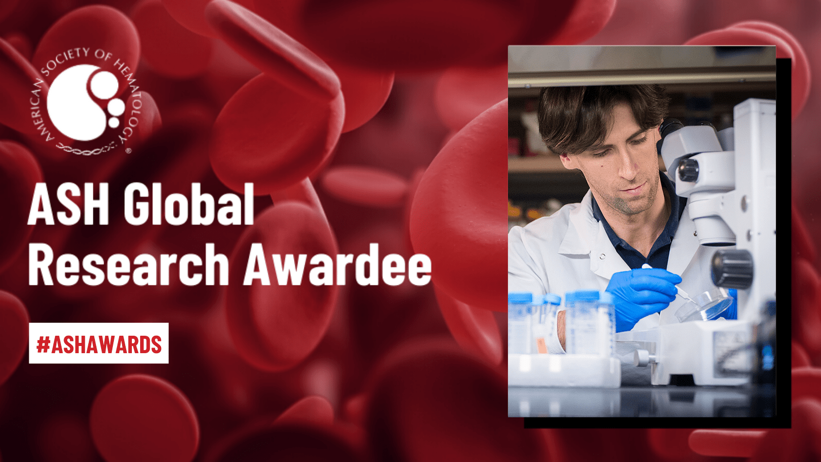 Miguel Ganuza receives ASH Global Research Award - Barts Cancer Institute - Queen Mary ...