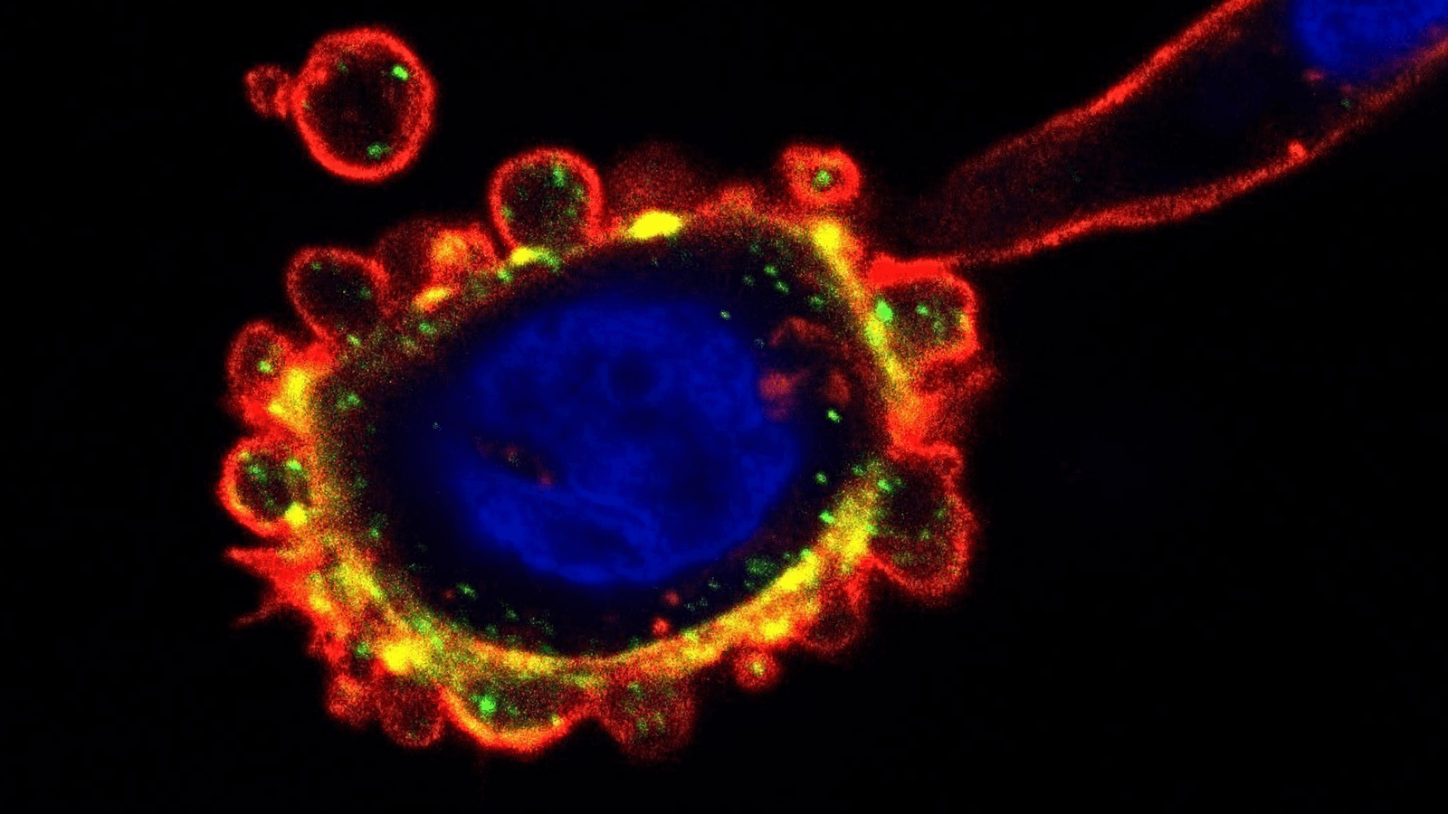 New study suggests promising approach for treating pancreatic cancer