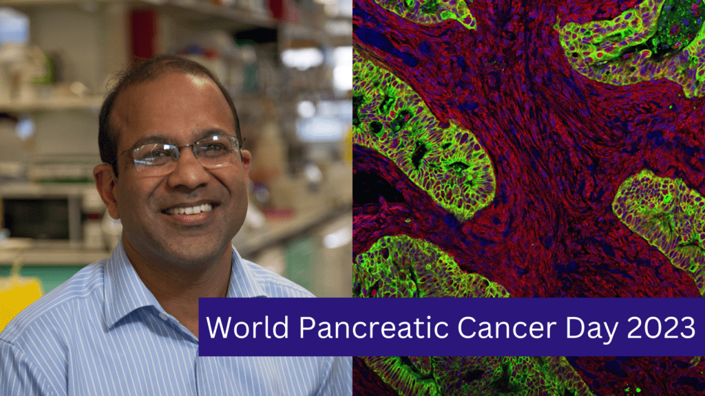 World Pancreatic Cancer Day: research reveals molecules that alter the ...