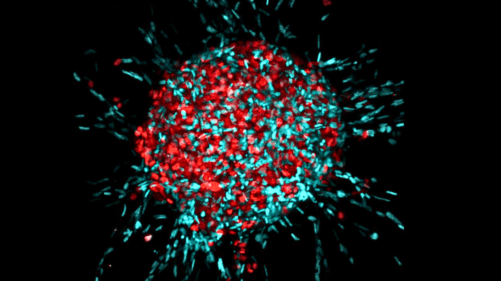 Video: mini-tumours shed light on how pancreatic cancer spreads