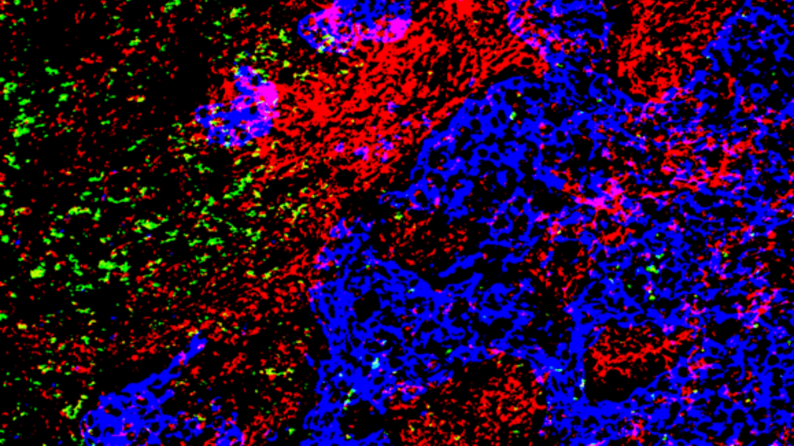 Scientists uncover protein with the power to help or hinder breast ...