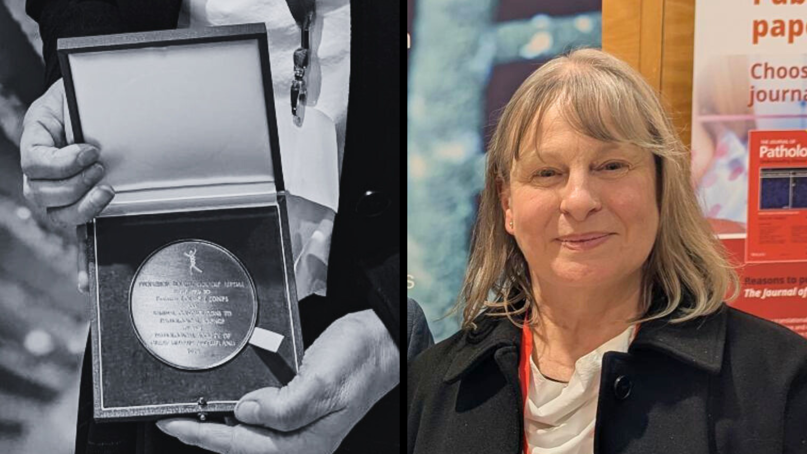 Professor Louise Jones wins Goudie Medal for excellence in pathology